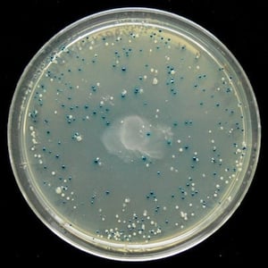 Plasmids 101: Screening Strategies Used in Plasmid Cloning