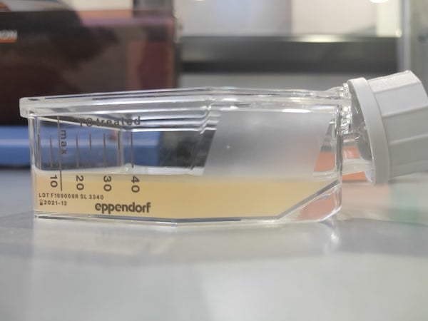 Mycoplasma Contamination: Where Does It Come From and How to Prevent It