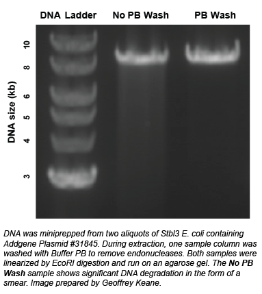 Plasmids 101: Optimizing Plasmid Yields