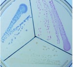 Chromoproteins: Colorful Proteins For Molecular Biology Experiments