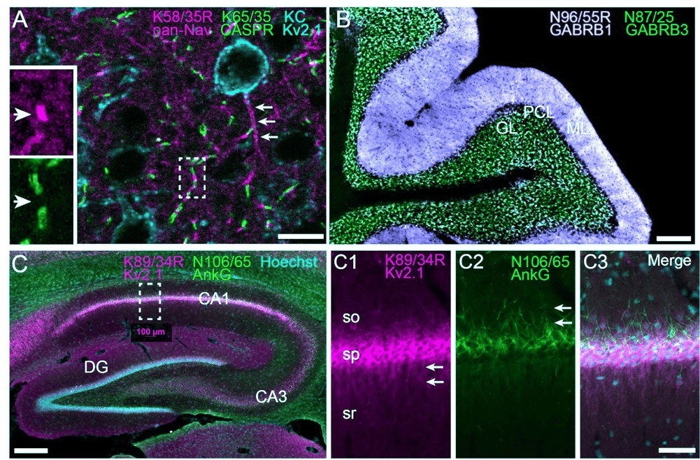 Antibodies 101: Multiplex Immunofluorescence